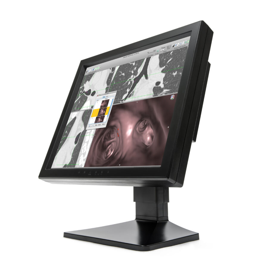 WIDE 19" 1mp Modality Color Monitor (CX10p) - WIDE-USA Monitors ...