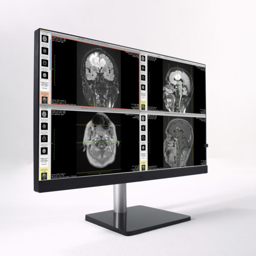 WIDE 23.8" 2.3mp Clinical Color Display (CL24N) - WIDE-USA: Medical ...