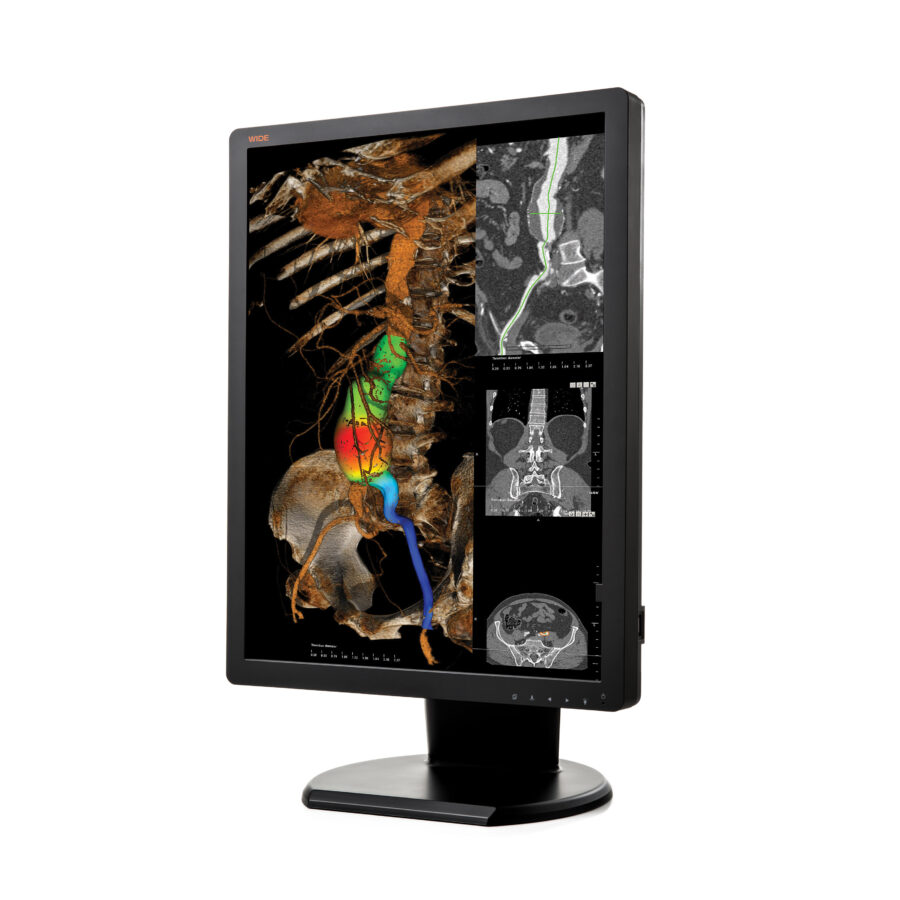 Buy WIDE-USA Medical Imaging Monitors and ATC Displays - Global Sales