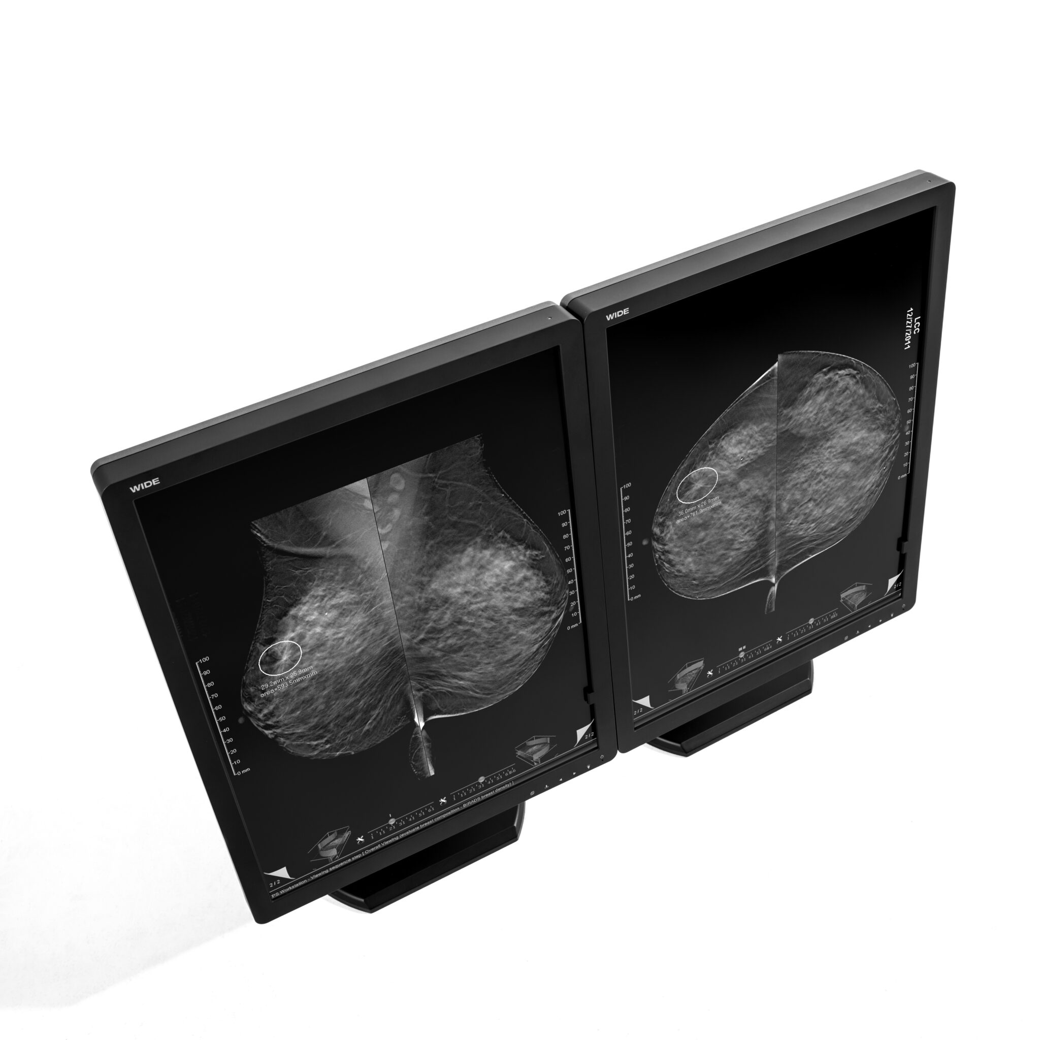 21.3" 5mp Mammo Tomo Mono Display (MX50N) - WIDE-USA: Medical Imaging ...