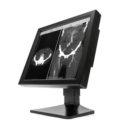 Buy WIDE-USA Medical Imaging Monitors and ATC Displays - Global Sales
